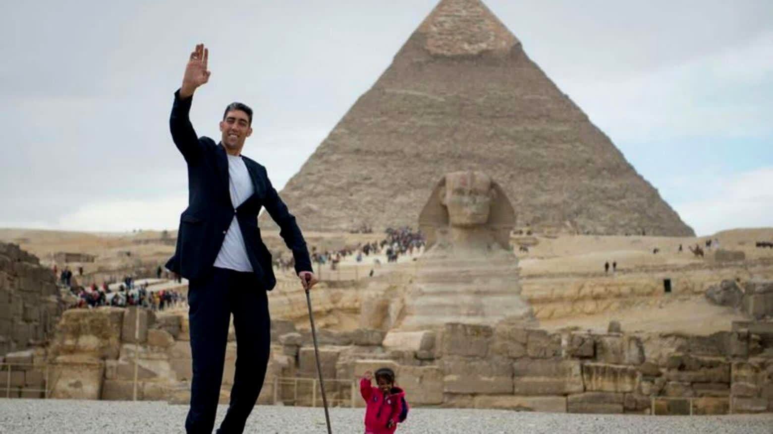 世界上最高的几个人!从未停止长高的原因居然是有病