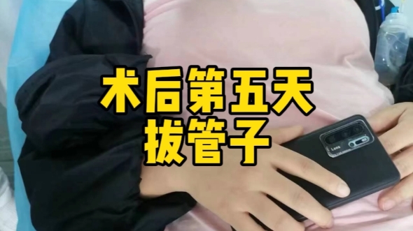 术后第五天,拔引流管