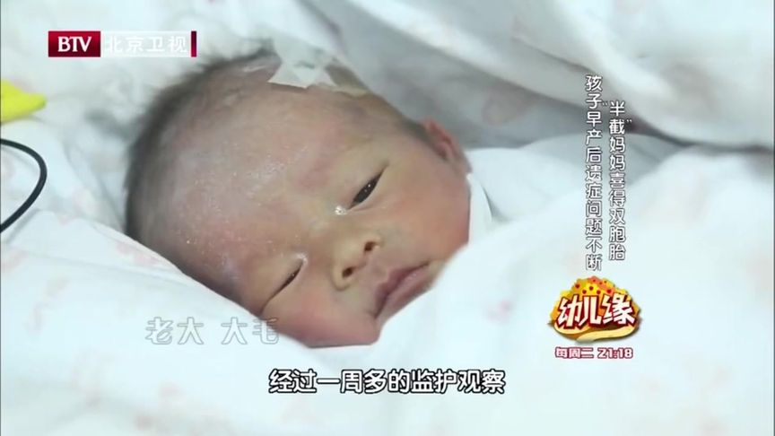 残疾人孕妇高位截肢,坚强的生下了双胞胎,生命的奇迹