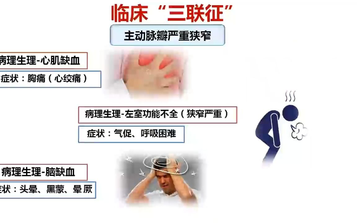 冠心病术后监护、IABP的应用护理、体外膜肺氧合(ECMO)技术 下