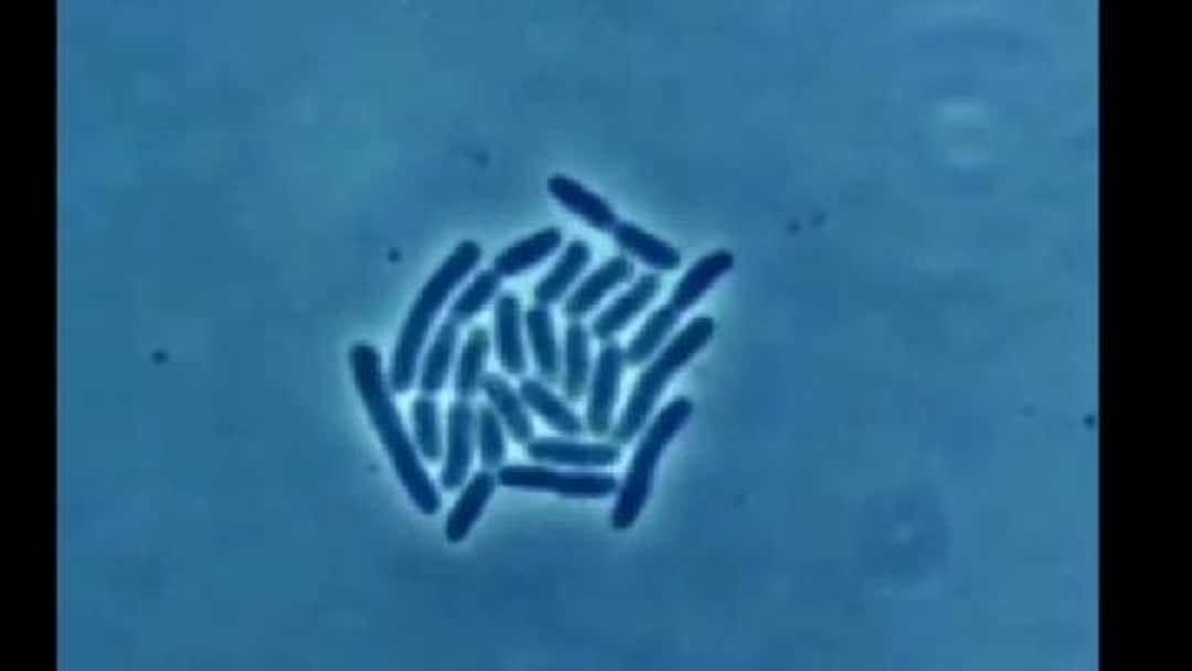 细菌是怎么分裂的你应该没见过吧?现在就带你看!