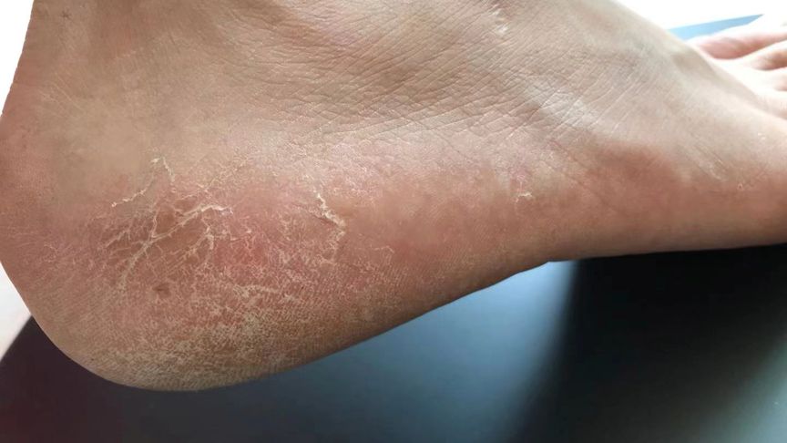 去脚死皮韩国磨脚神器