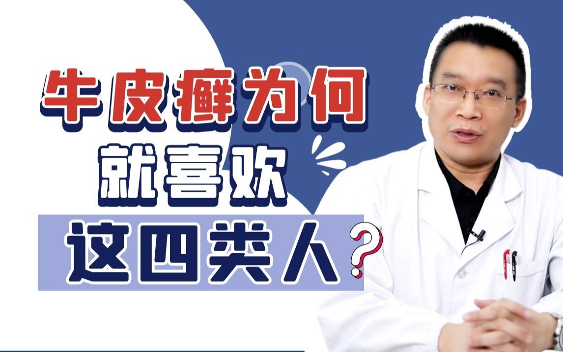 【皮肤科老钱】退!退!退!牛皮癣就喜欢找上这四类人?