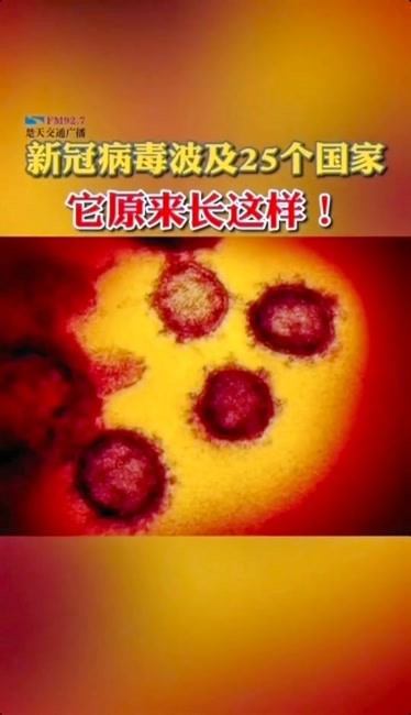 新型冠状病毒究竟长什么样?透过显微镜,可以近距离观察。