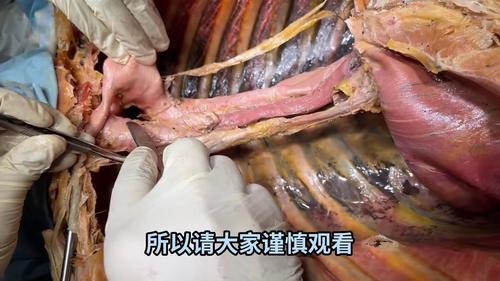 来看看气管在人类胸腔内的结构