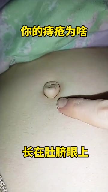 你的痔疮为啥,长在肚脐眼上 #搞笑配音 #笑点不打烊计划 #搞笑视频 @...