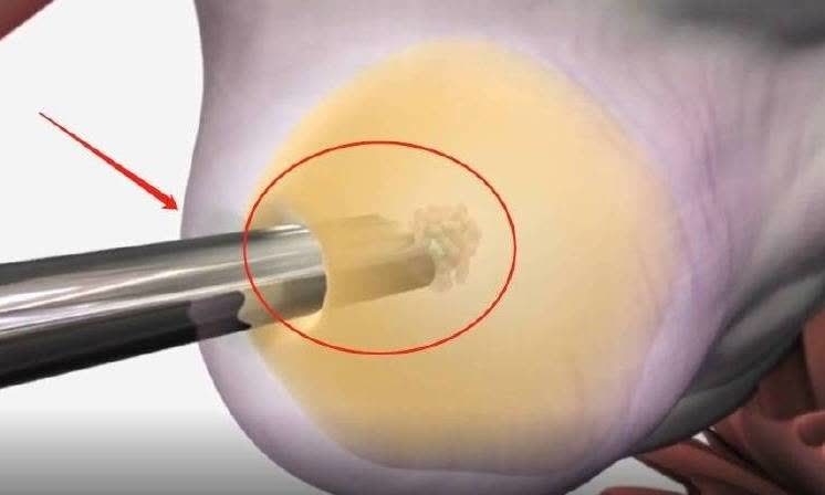 受精卵是如何产生的?3D模拟全过程,看完恍然大悟