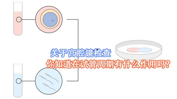 于宫腔镜检查,你知道在试管周期有什么作用吗?