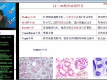 执业医师考试 基础课程 病理 第01章-细胞组织的适应、损伤与修复(79...