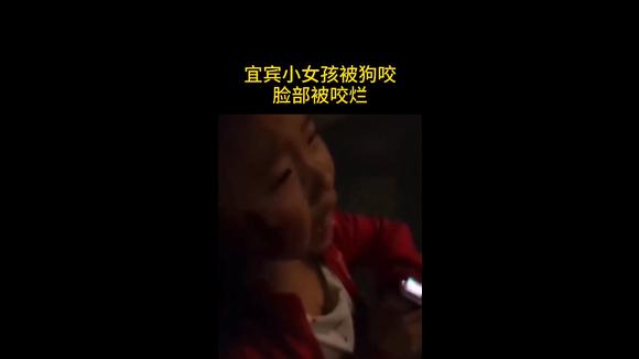 小女孩被狗咬,脸部被咬烂