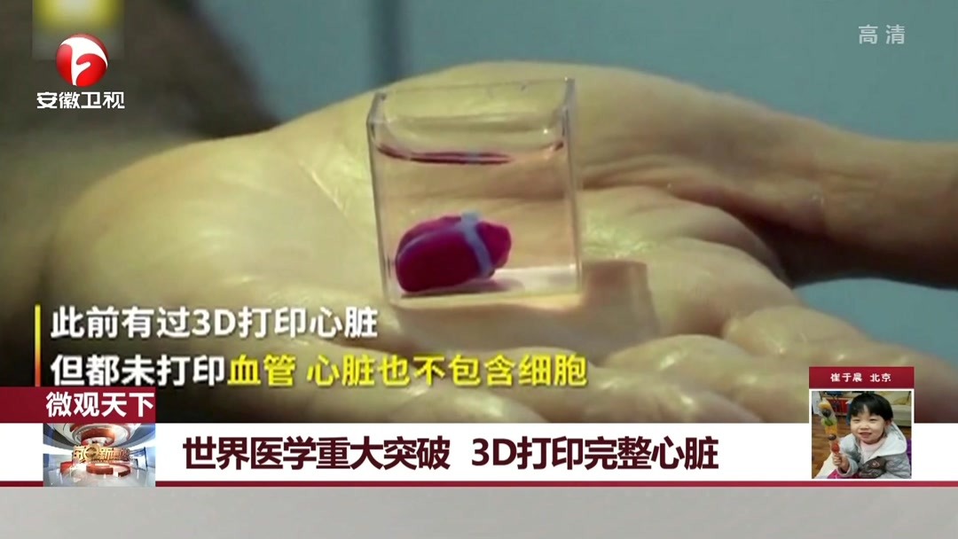 世界医学重大突破 3D打印完整心脏