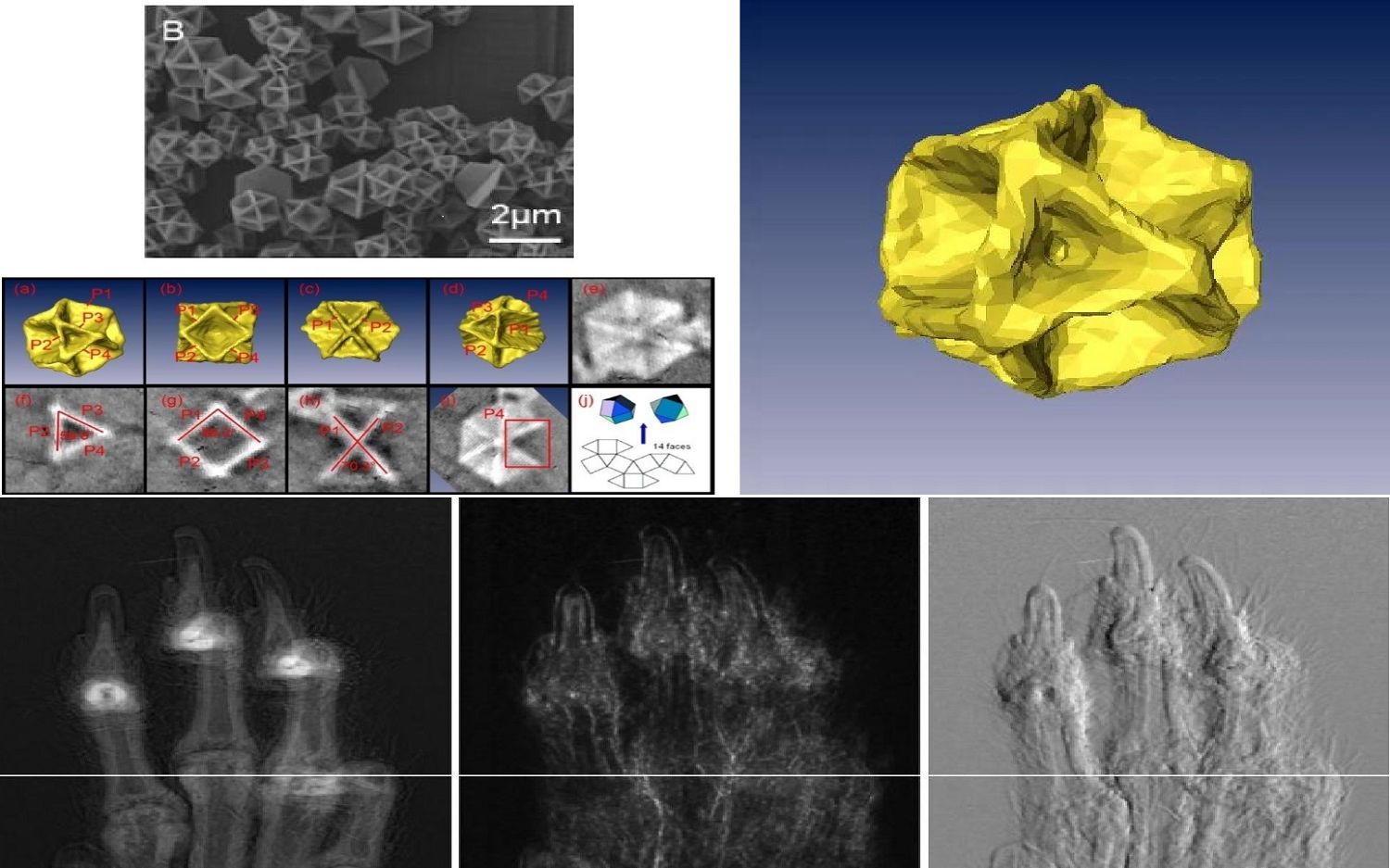 【高能科普】做了这么多次CT,你知道CT怎么工作的吗?