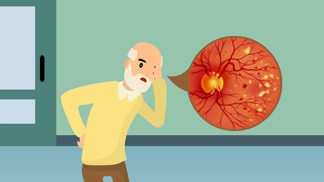 糖尿病有治愈的可能吗?