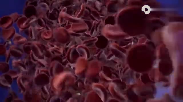 超酷医学视频 动画演示下肢静脉血栓是如何导致肺栓塞的!