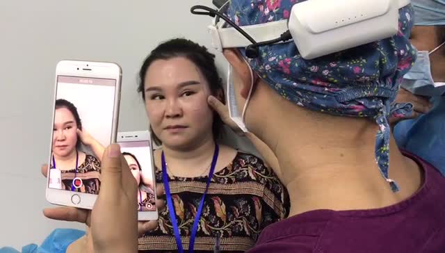 如何做好线雕提升术,术前设计的重要性听南大医美教育解析学习咨询...