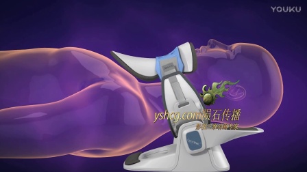 制作医学医疗三维动画宣传片,逼真程度震惊了医学界