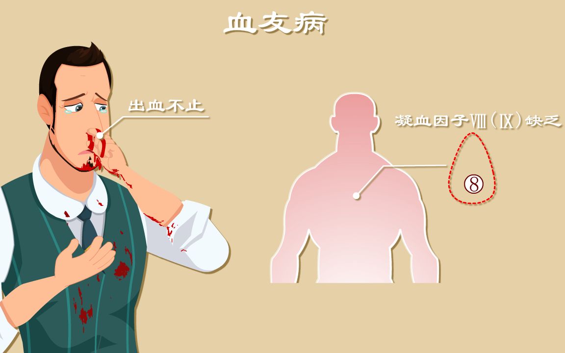 血友病3:科学解密止血过程