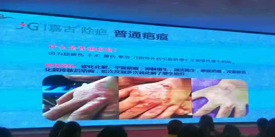普通疤痕是如何修复的?