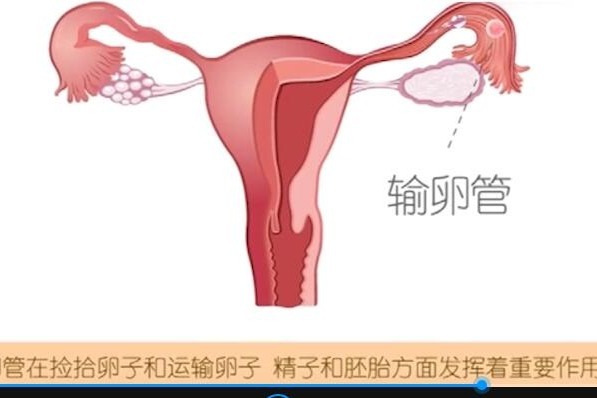 北京不孕不育医院 - 不孕不育输卵管因素 - 北京卫人不孕不育医院