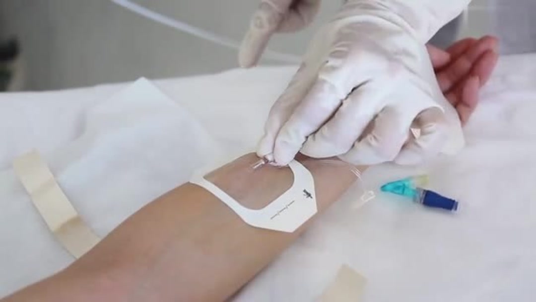 静脉留置针技术 冲封管操作-大庆油田总医院