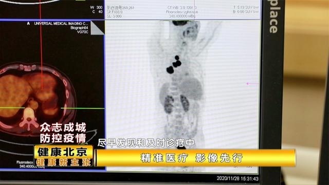 中国每分钟有7人确诊癌症!及早发现、精准治疗成为大众关注焦点