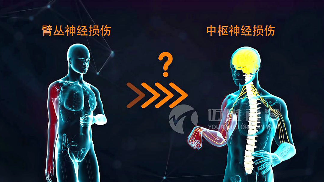迈维动漫神经系统医学三维动画制作,药物作用机理演示动画