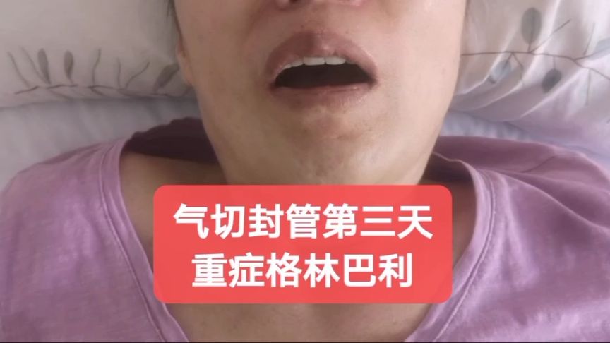 气切封管第三天了