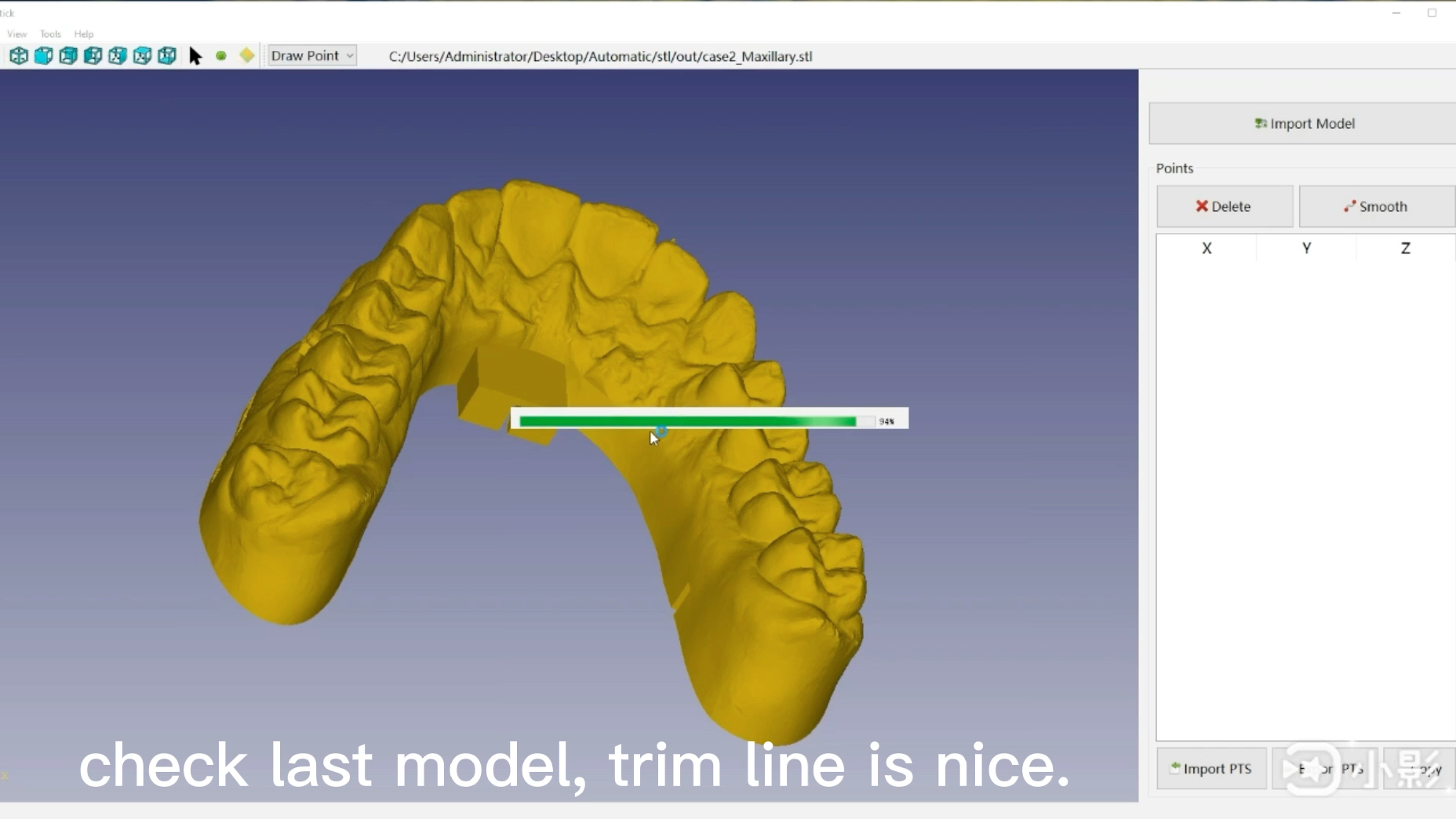 隐形正畸牙套生产软件,一键生成,批量处理,不需要人为干涉。只需要将...