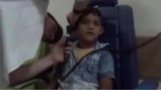 恶心!土耳其男孩耳朵中掏出多只蠕动蛆虫