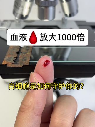 显微镜下的血细胞#显微镜下的世界 #实验室日常 #科普一下 #在你撑不...