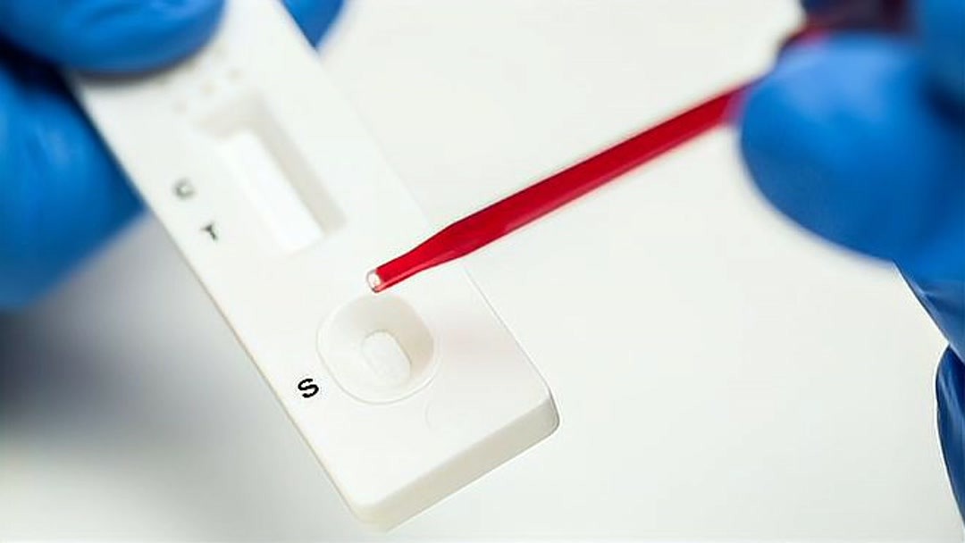 自己在家测抗原的时候,显示下面深上面浅,咋回事