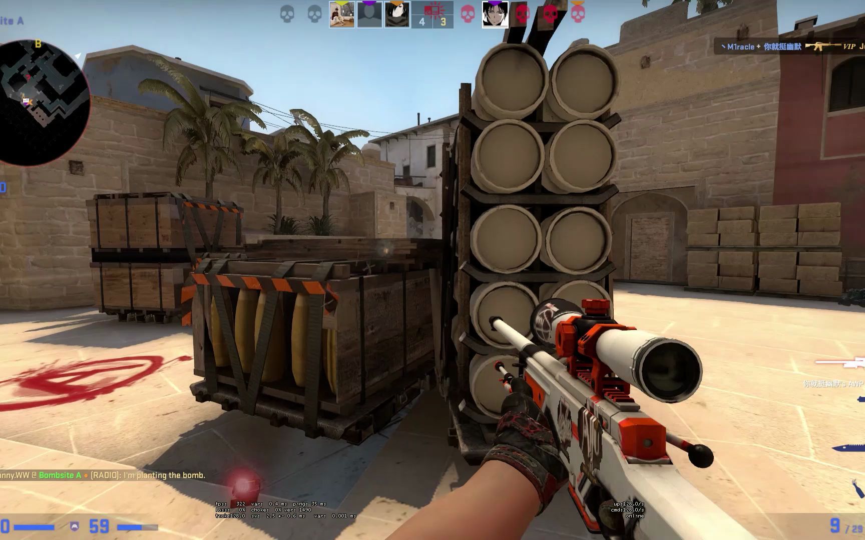 【CSGO】机械瞄准顿悟小子