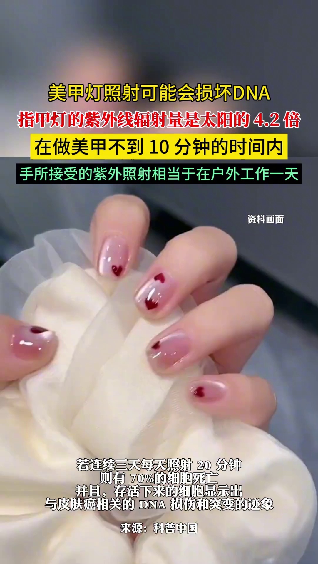 美甲灯照射可能会损坏DNA,指甲灯的紫外线辐射量是太阳的 4.2 倍,在...