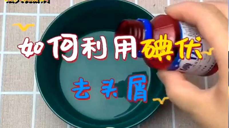 碘伏除了消毒原来还可以这样用,学会这招,你的头屑去无踪