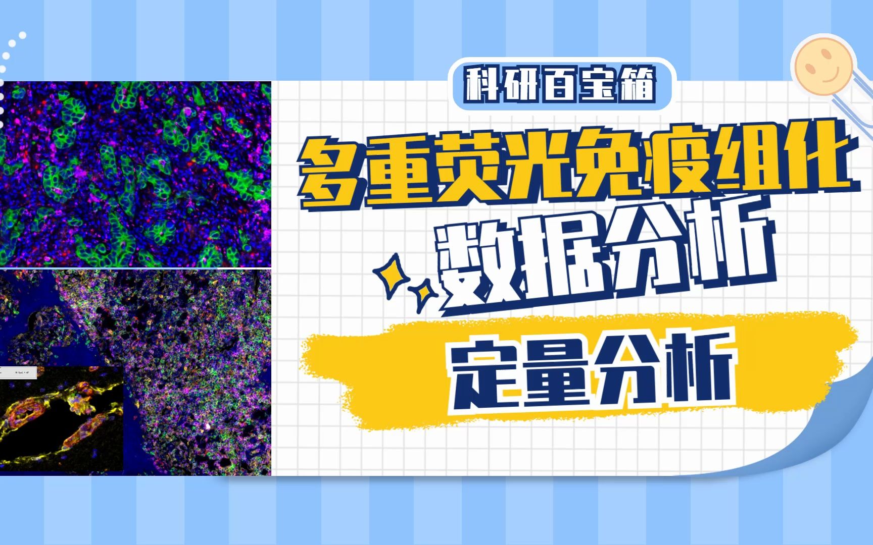 多重荧光免疫组化数据分析——定量分析