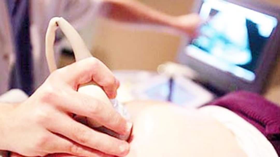 最详细的孕期超生解答 妇产科专家告诉你孕期要做几次超声