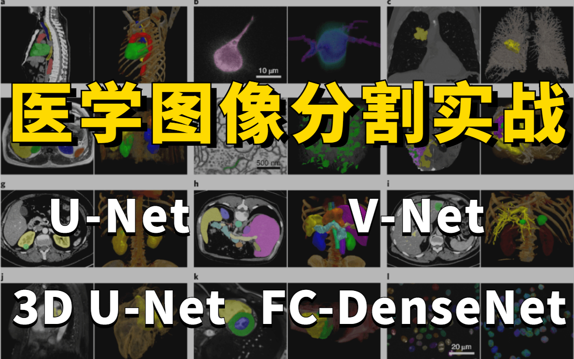 基于U-Net实现医学图像分割,3D U-Net\V-Net\FC-DenseNet全详解!上...