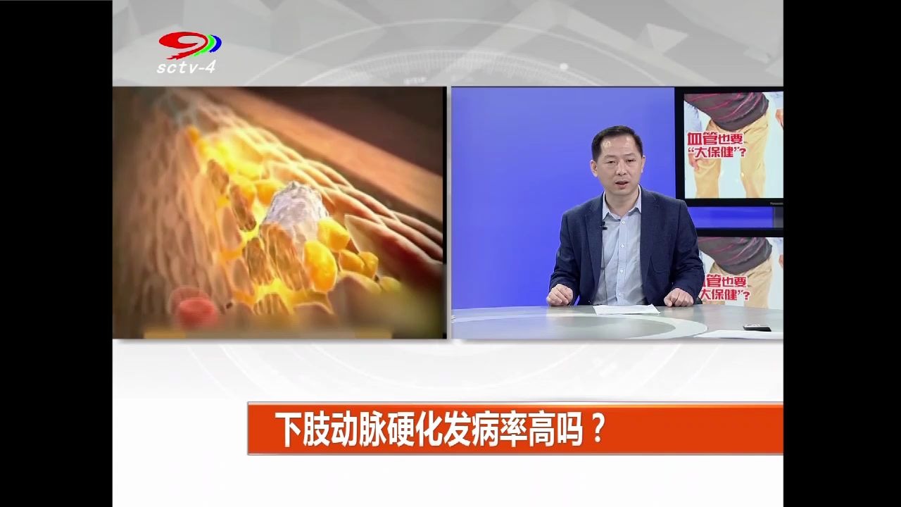 下肢动脉硬化高发人群及每阶段的症状表现