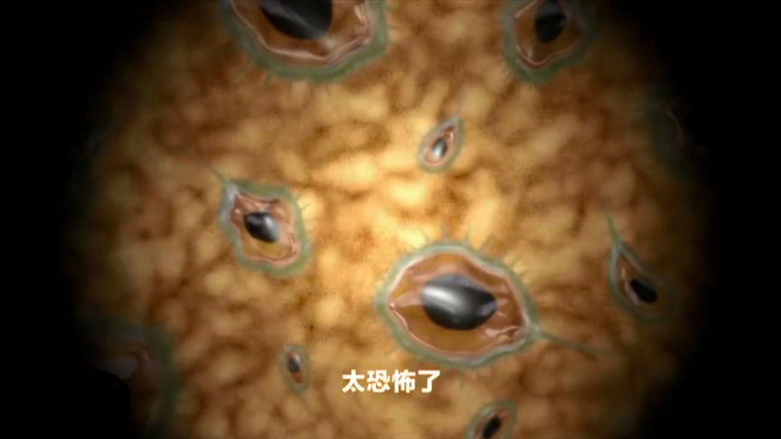 螺丝钉:吉姆洗了五遍手,用显微镜一看,手上都是细菌!