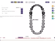 ...CAD&CAM系统ExoCad DentalDB CAM&CAD 2011-2015版演示教程