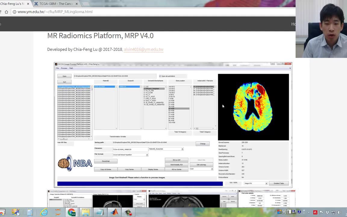 ...数据预处理及DICOM导入/Data Preparation and DICOM Import on MRP