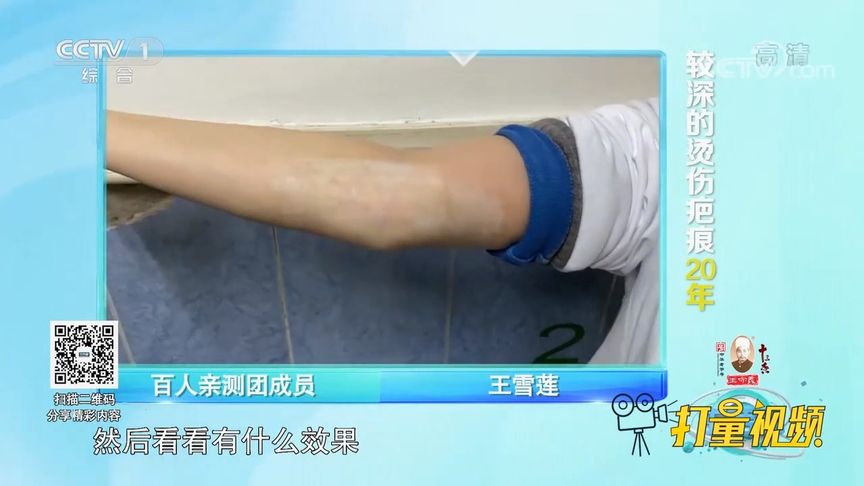 去除旧疤,迅速见效?疤痕一抹消好评一片,实际效果如何|生活圈
