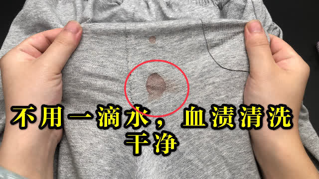 不管衣物上血渍多顽固,不用一滴水,新老血渍轻松洗掉,实用