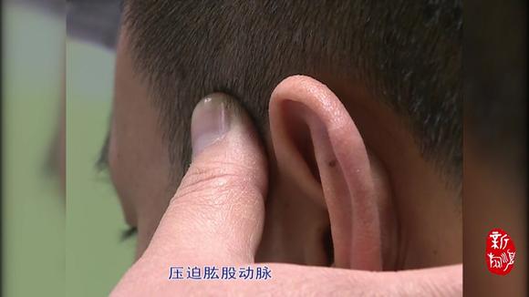 出现意外你会快速止血吗 骨折后怎样包扎避免二次损伤