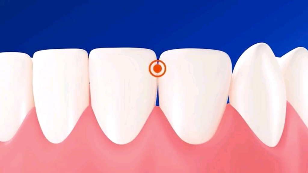 贝牙老赵来分享—如何正确使用牙线