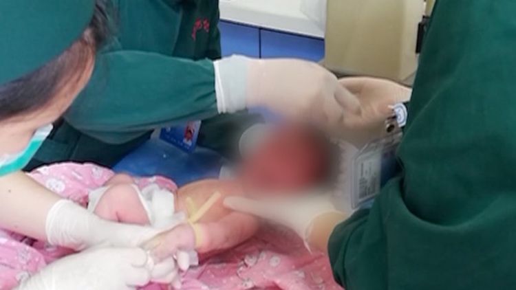 新生女婴遭遗弃耳朵爬满蛆虫 护士心疼哭了.