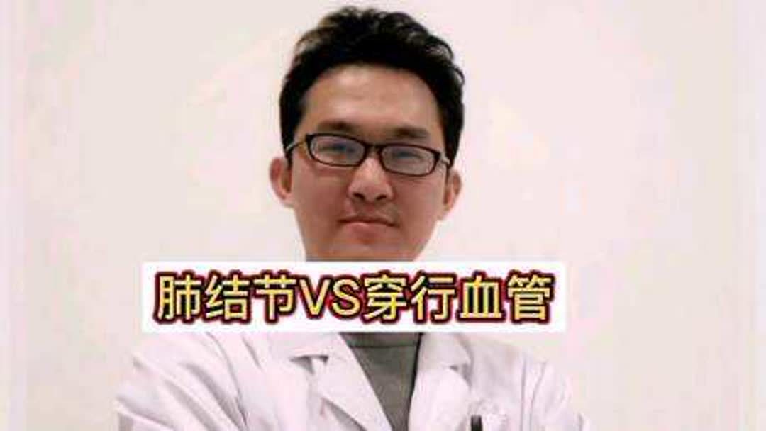 看看你的肺结节有没有血管穿行,如果穿行血管有以下征象要注意了