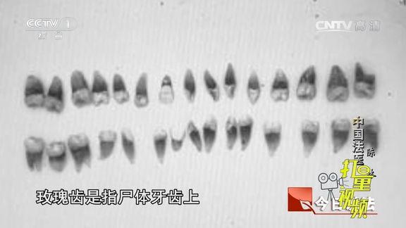 中国法医陈林2:通过线索法医推断出死者死亡时间,却发现新线索