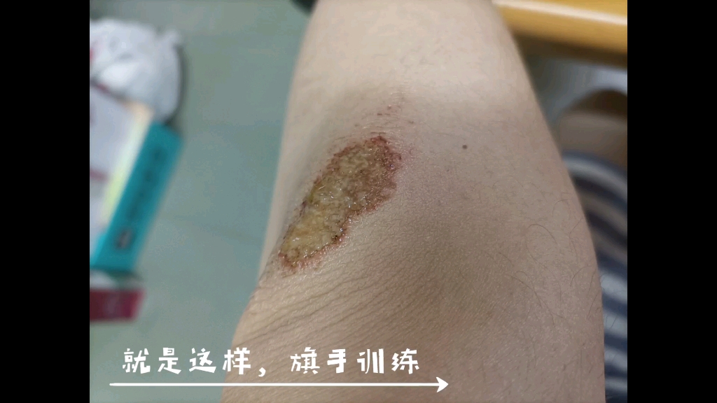 旗手训练日志5