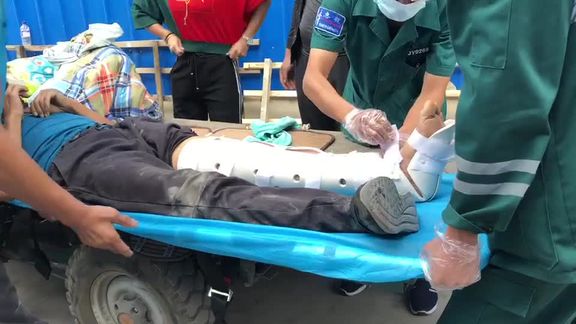 被石材砸伤骨折,千万别私自移动,否则很可能造成二次损伤。@头条健康